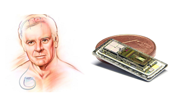 ICSENSE AND INNOVATIVE STARTUPS: THE PERFECT MATCH - AnySilicon